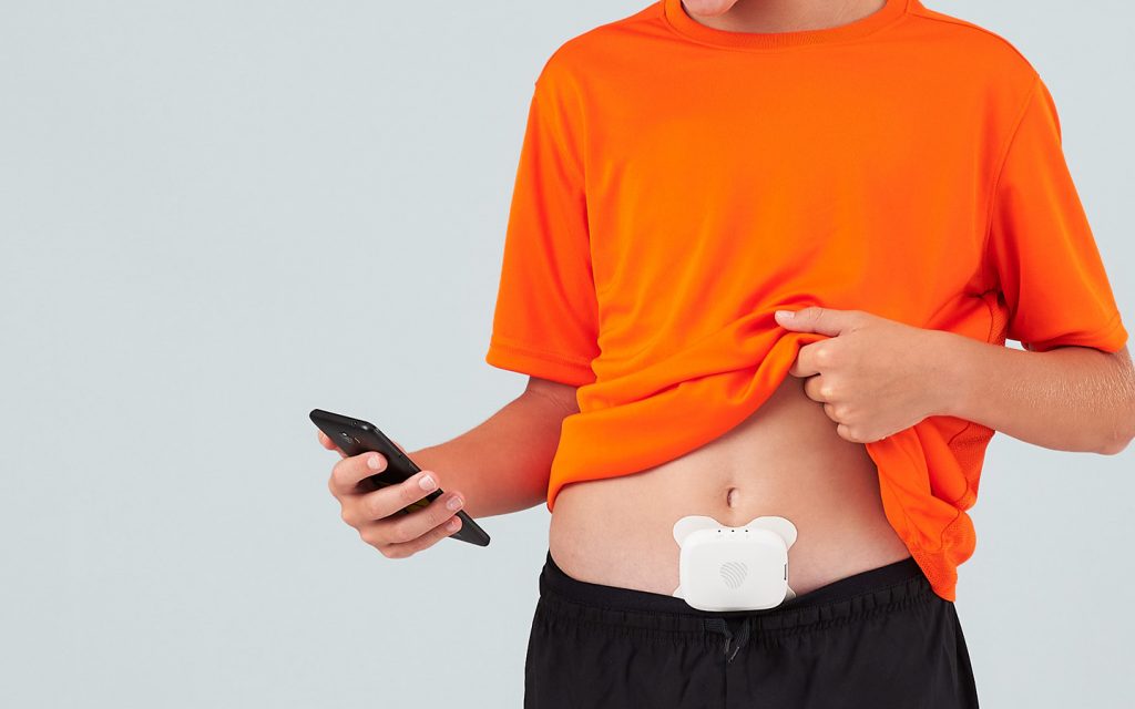 How it works - SENS-U KIDS Bladder Sensor - Novioscan